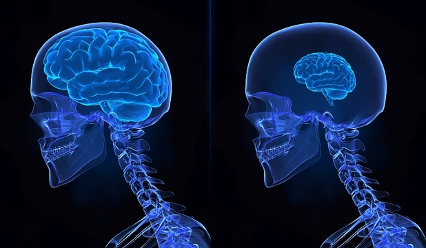 De ce ni se micşorează creierul: unul dintre cele mai mari mistere ale ...